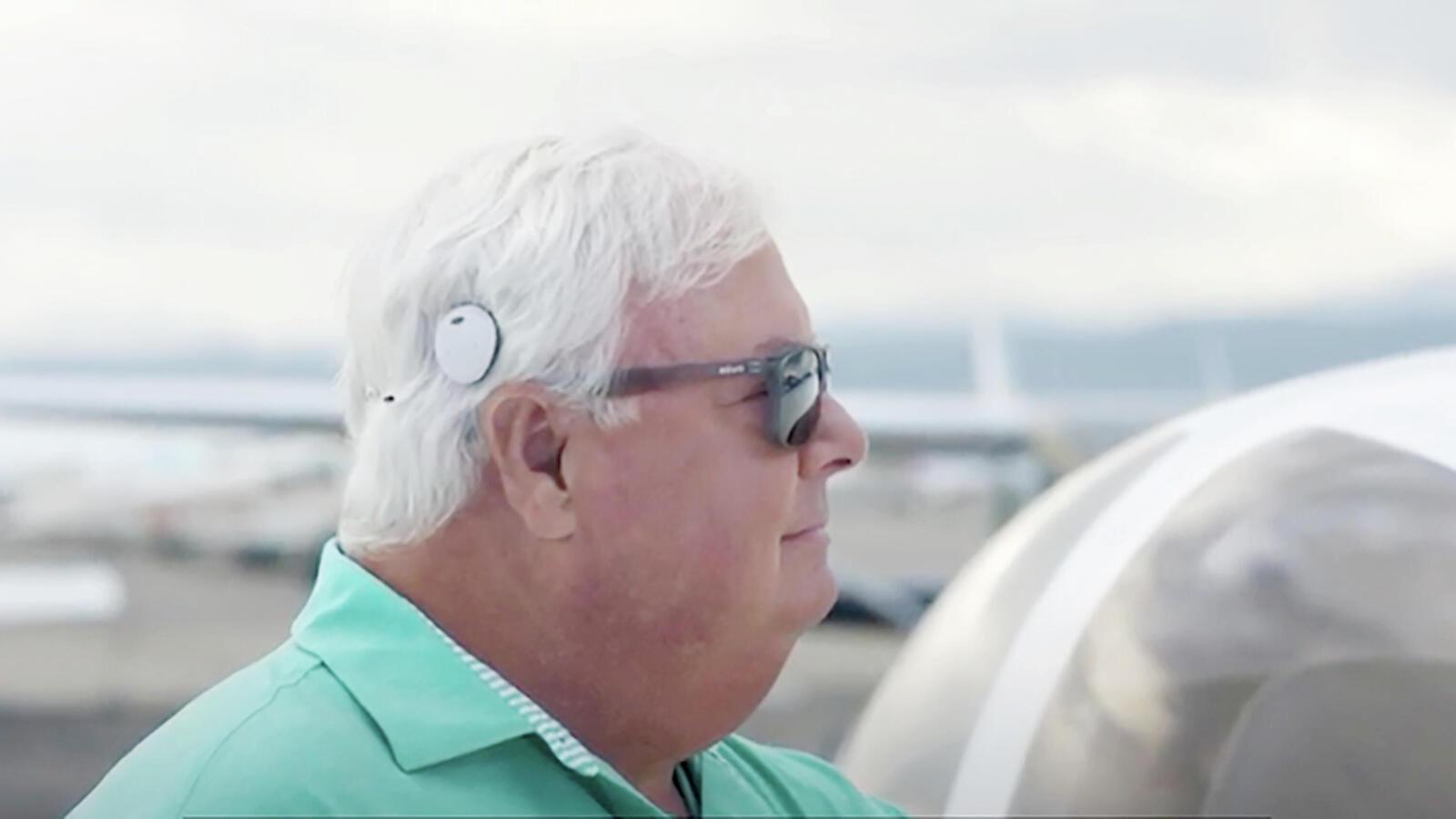 Cochlear™Osia® Sound Processor | Cochlear